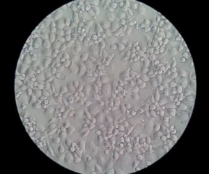 THP1细胞诱导分化巨噬细胞操作手册 – 王进的个人网站