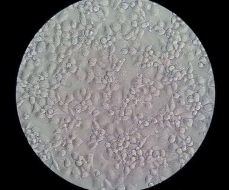 THP1细胞诱导分化巨噬细胞操作手册 – 王进的个人网站